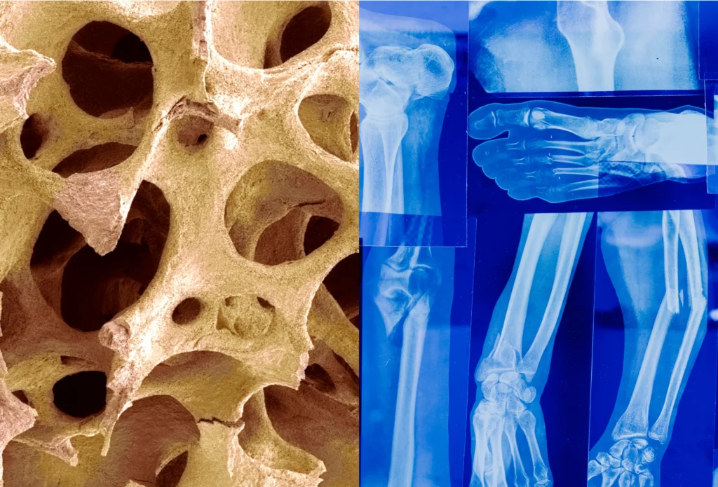 A Guide To Engineering Bone Scaffold Structure Design